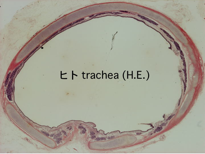 Human trachea H.E.